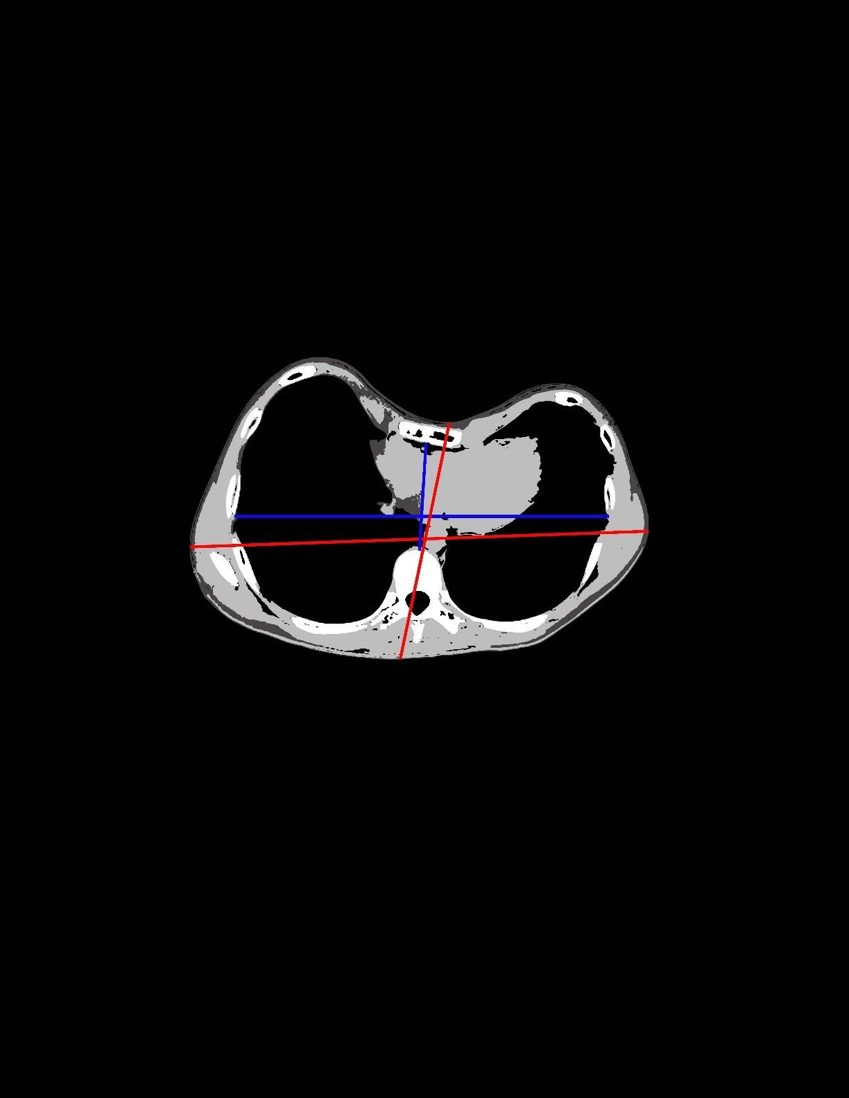 New Technology Committee | PedSurg Resource